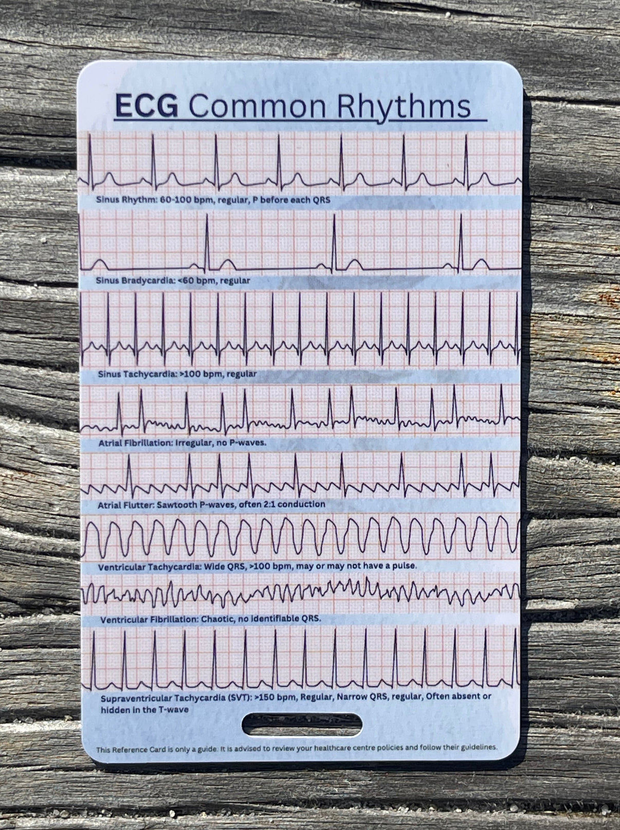 ECG Rhythms + Guide Reference Card – The Nurse Deck