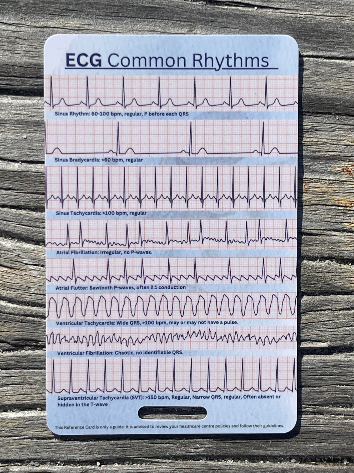 ECG Rhythms + Guide Reference Card – The Nurse Deck