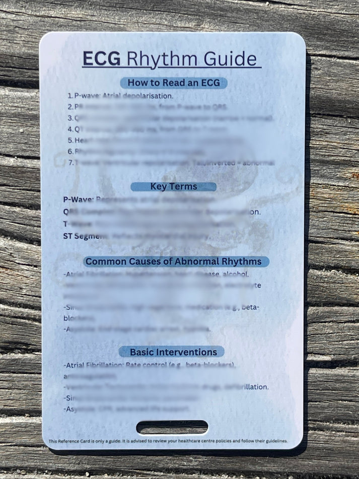 ECG Rhythms + Guide Reference Card – The Nurse Deck